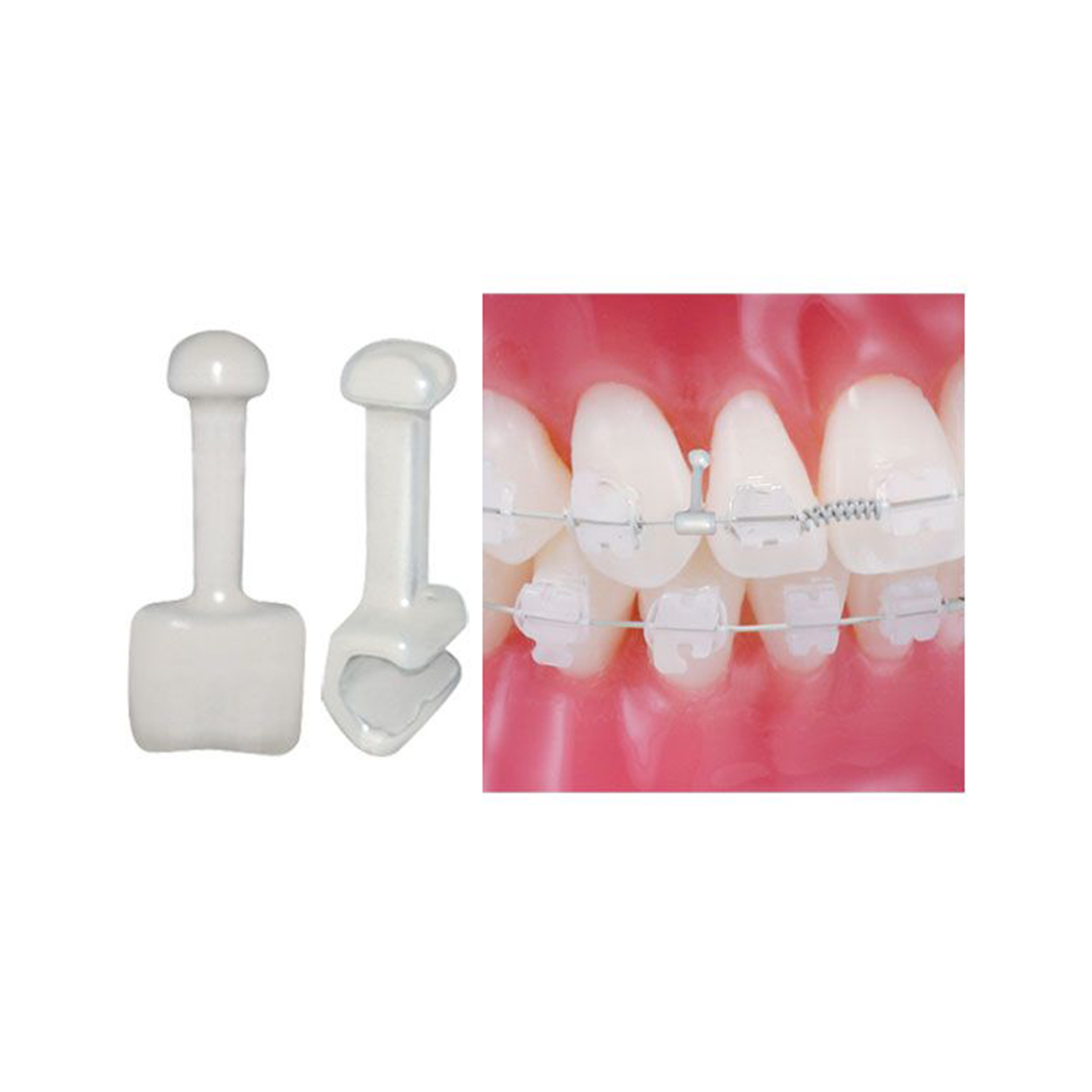 271052 : Tooth Coloured Coated Crimpable Ball Hooks