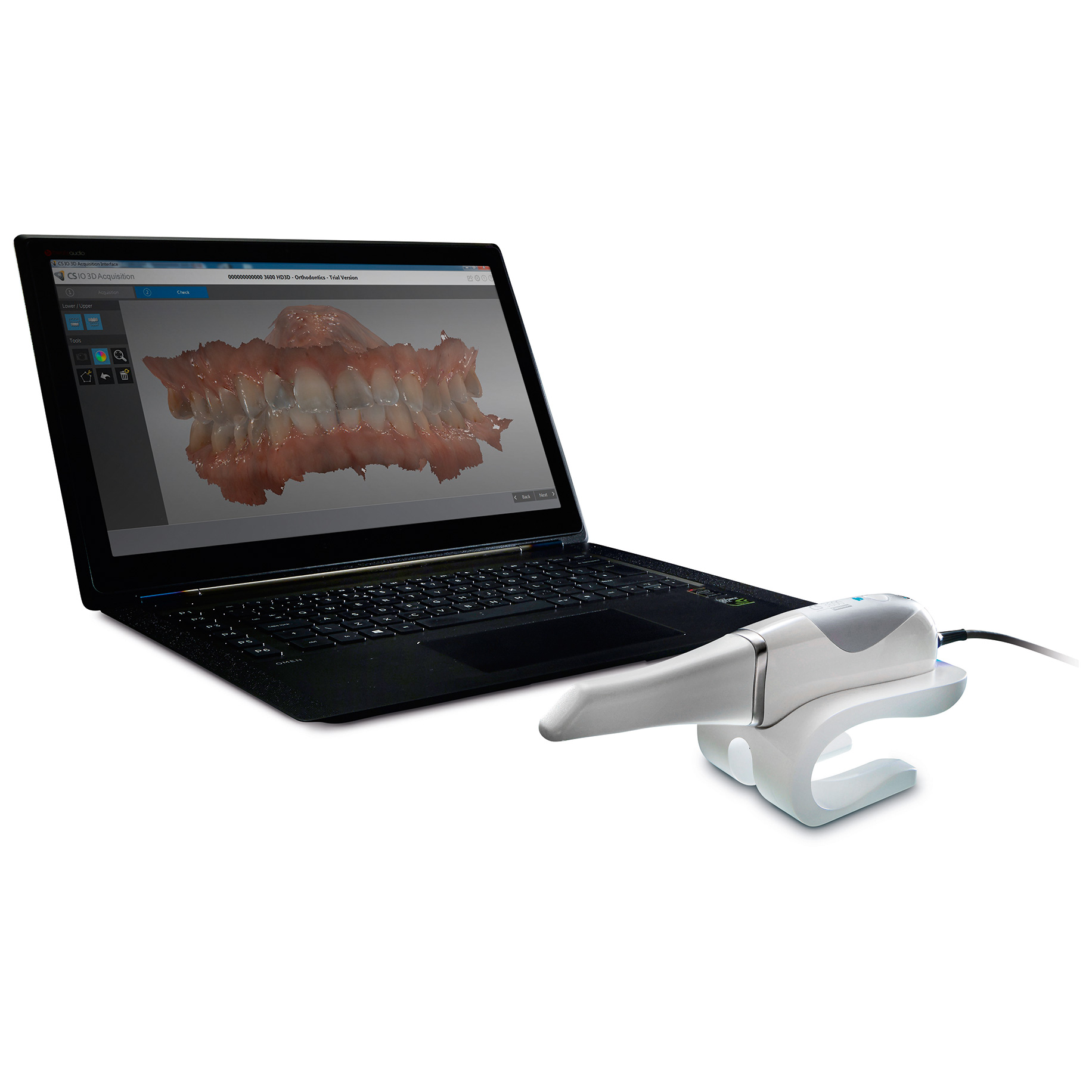 QWC360 : CS 3600 Intraoral Scanner
