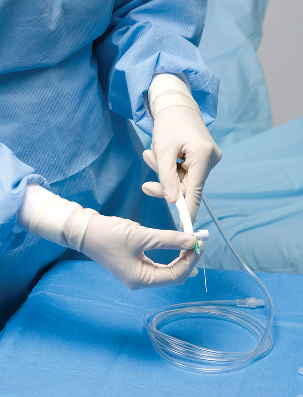 SFO025 : Irrigation System Accessories Sterile Omni Manual Irrigator